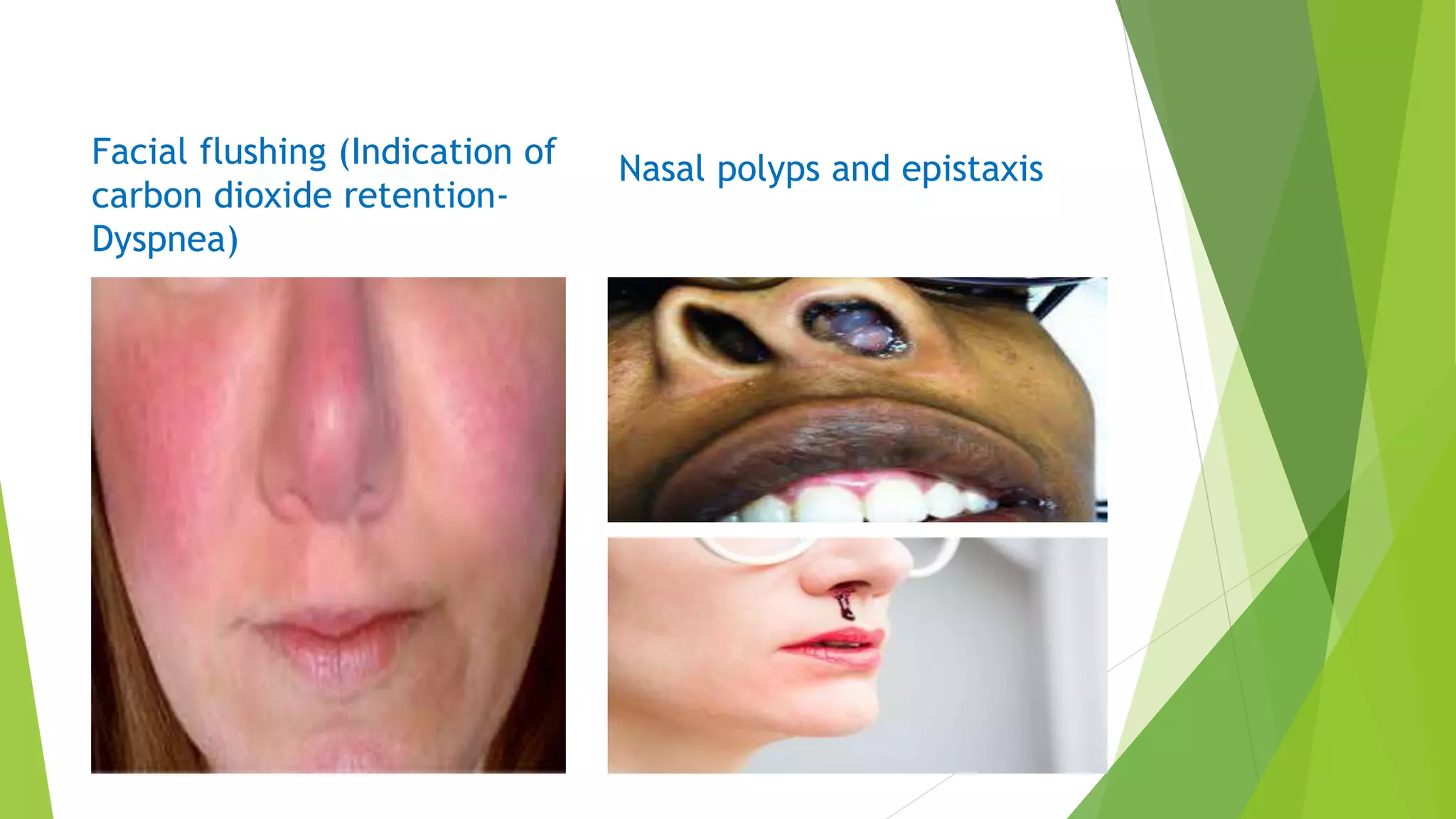 PHYSICAL ASSESSMENT OF THORAX AND LUNGS..pptx