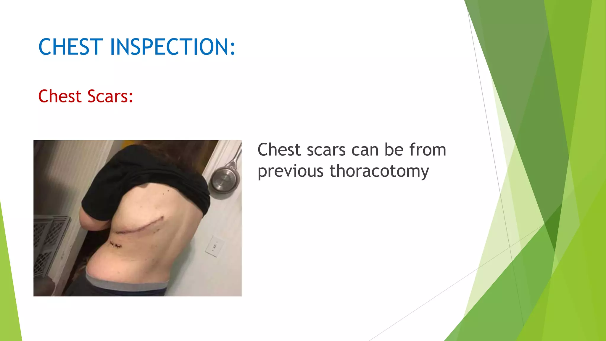 PHYSICAL ASSESSMENT OF THORAX AND LUNGS..pptx