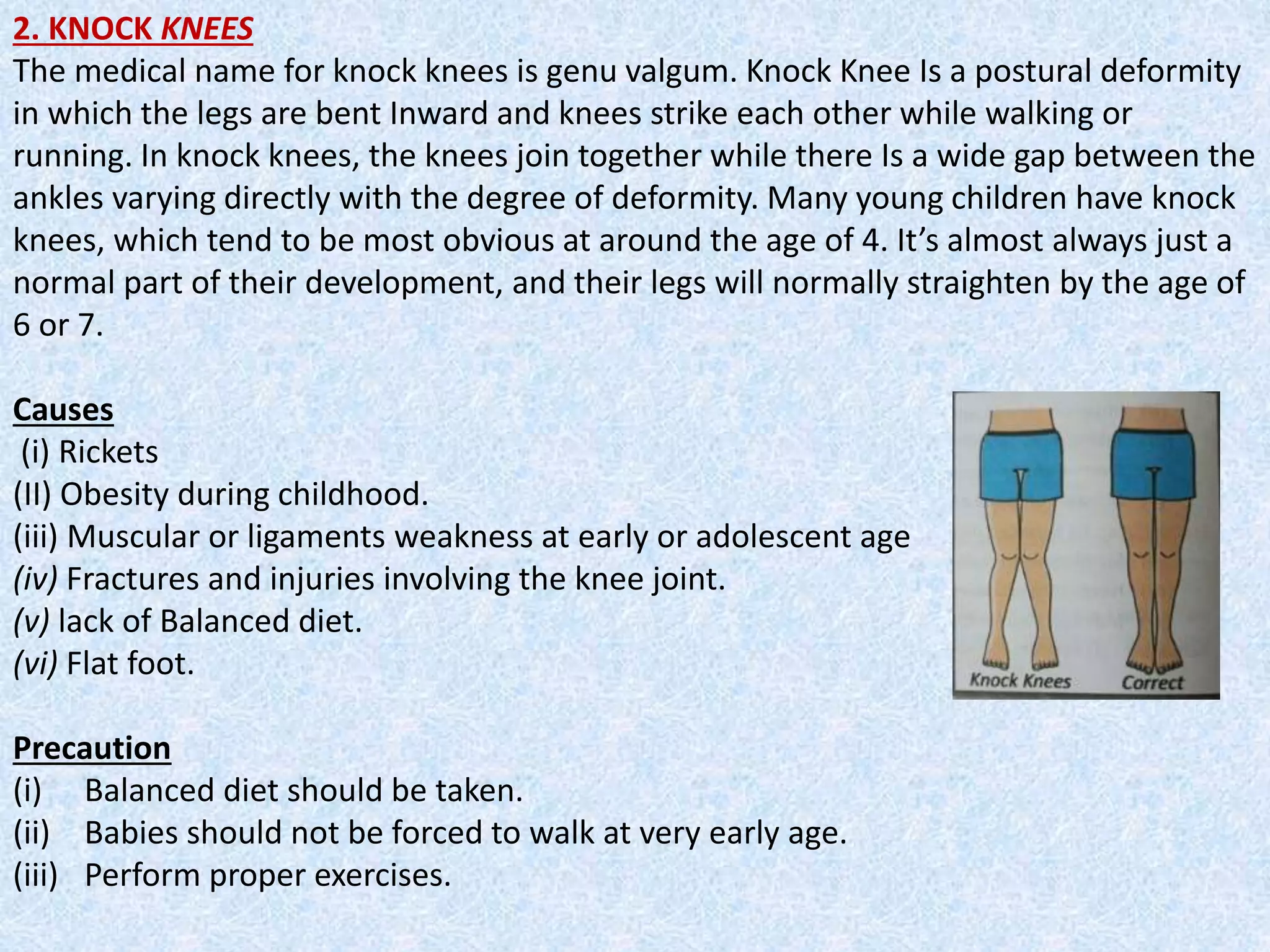 Physical education children and women in sports-class XII -UNIT 5 PPT ...