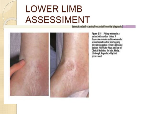 Physical examination | PPT