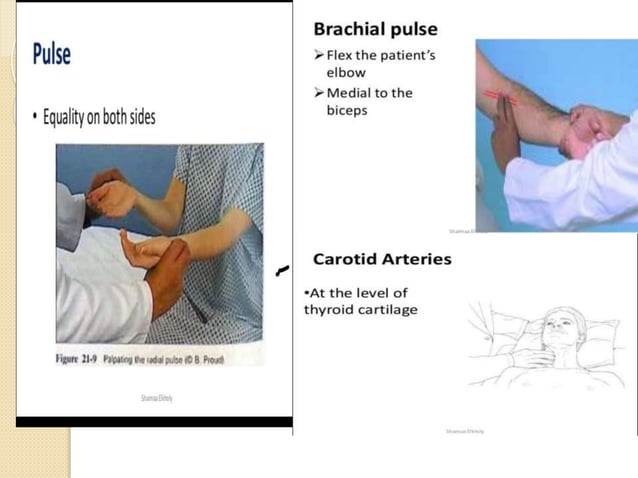 Physical examination | PPT