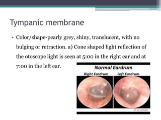 Tympanic Membrane Exam Slidesho