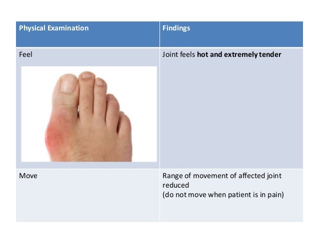 Physical examination for gout