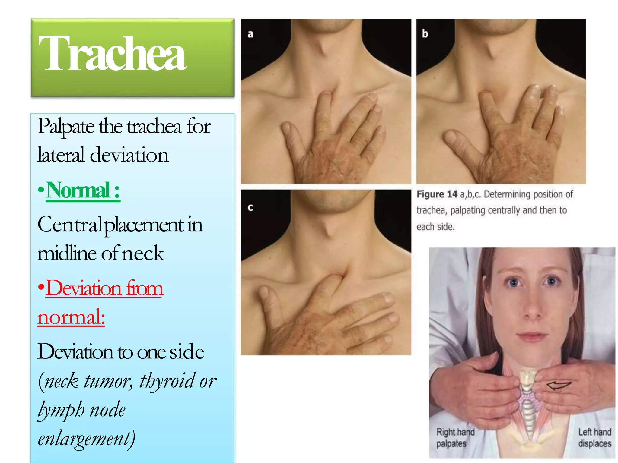 physical examination head and neck.pptx
