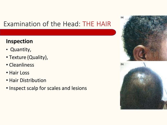 physical examination head and neck.pptx | Ear, Nose and Throat ...