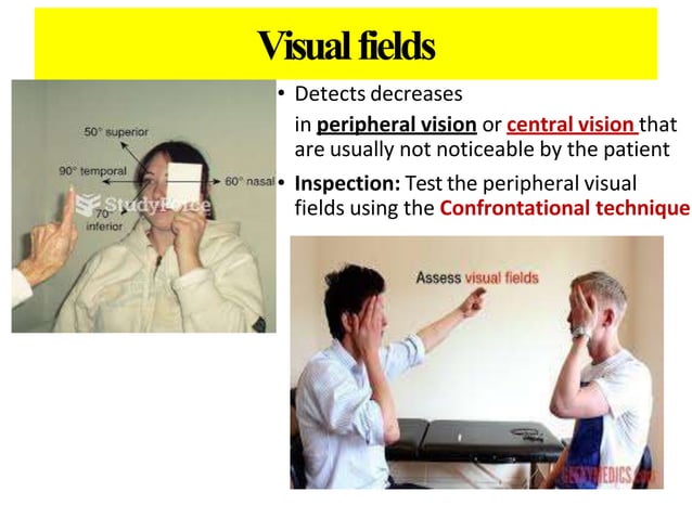 physical examination head and neck.pptx | Ear, Nose and Throat ...