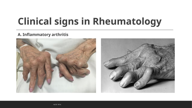 Physical Examination In Rheumatology.ppt