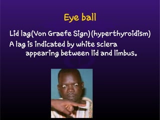 Physical examination of the head and-neck | PDF