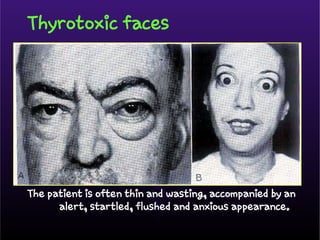 Physical examination of the head and-neck | PDF