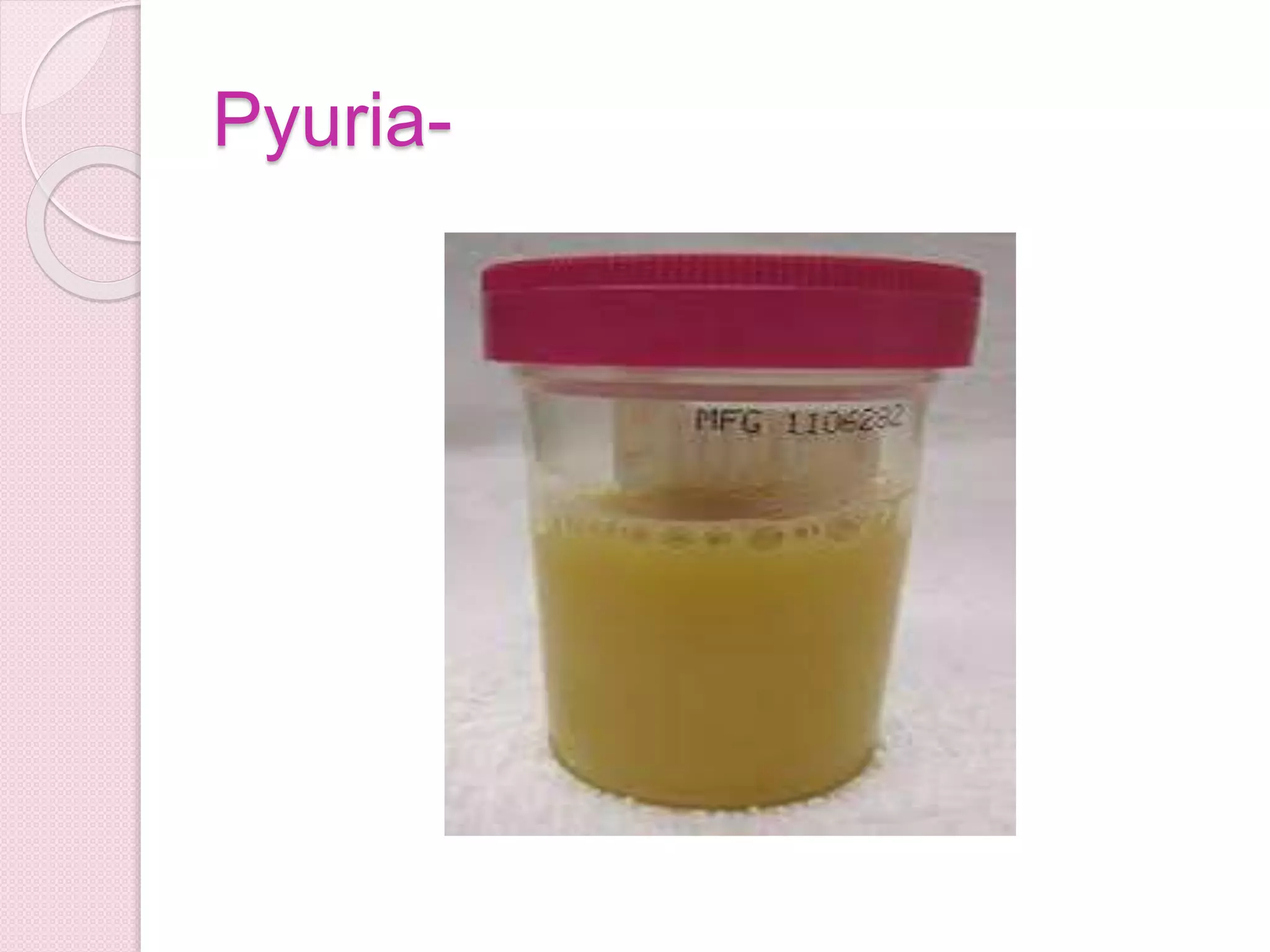 Physical examination of urine | PPTX