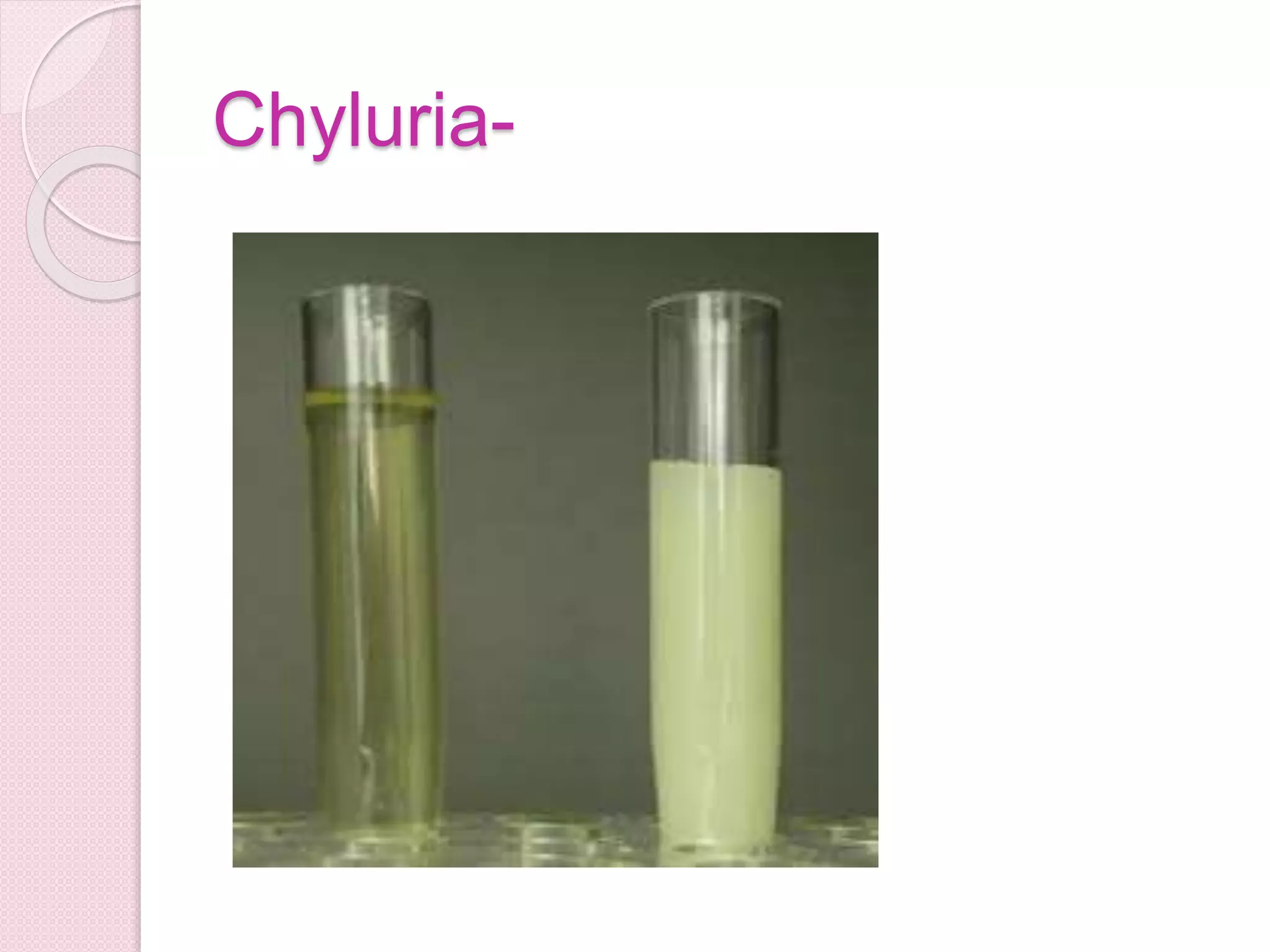 Physical examination of urine | PPTX