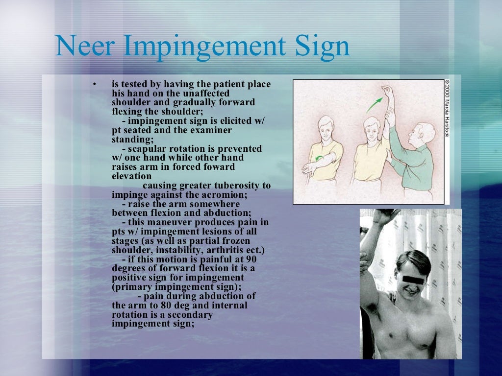 Physical examination signs
