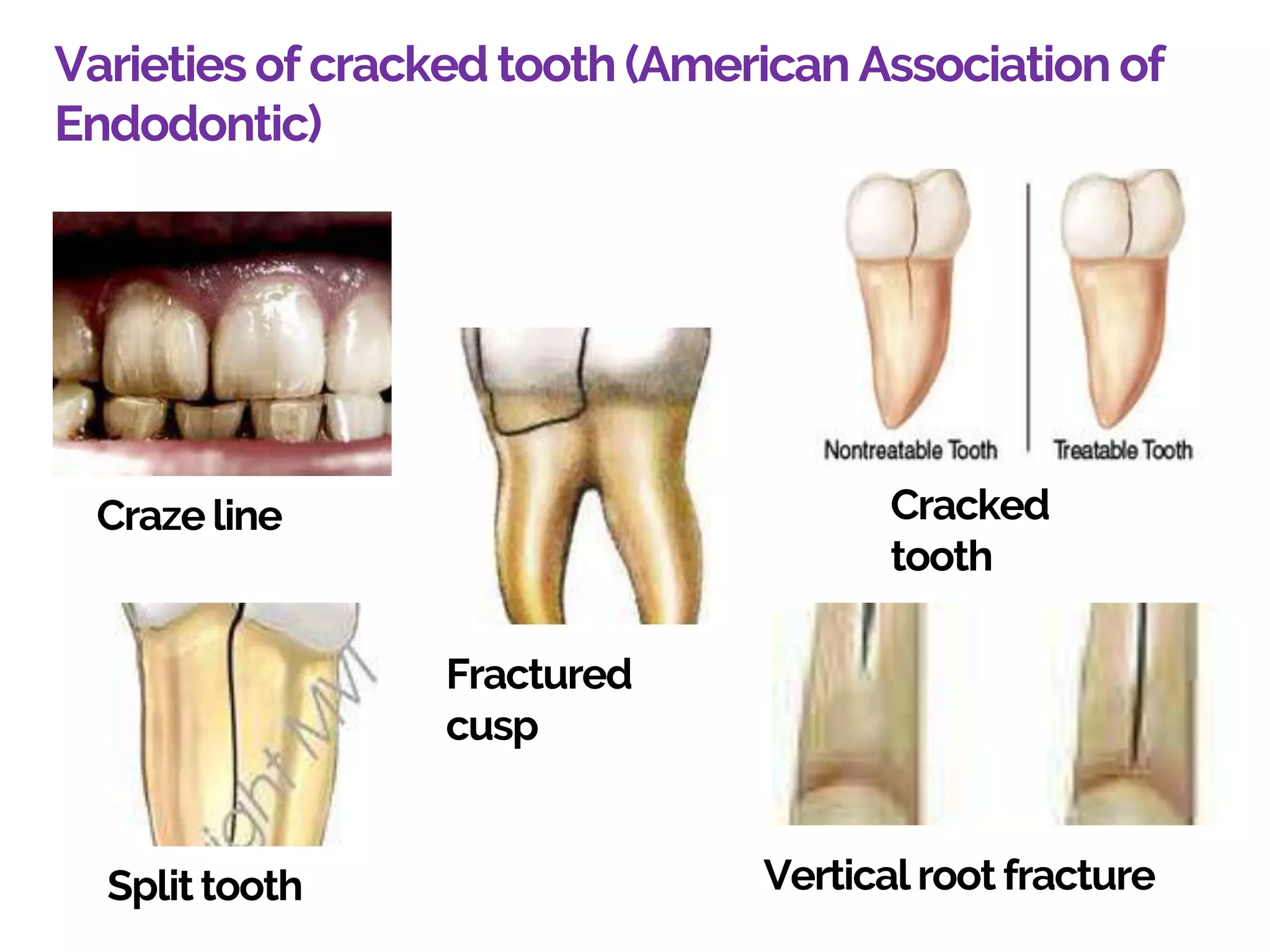 Physical injuries of oral cavity.pptx