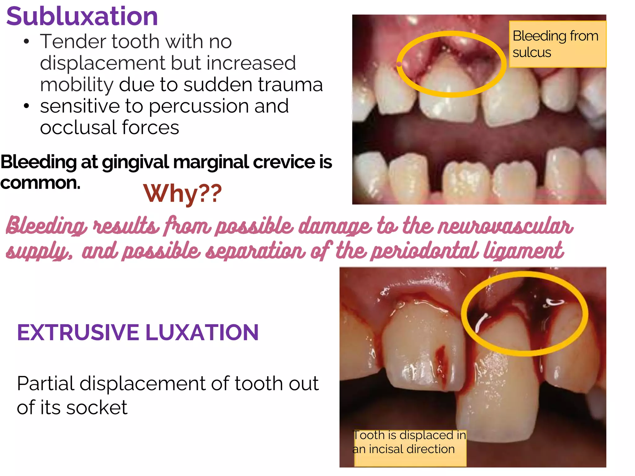 Physical injuries of oral cavity.pptx