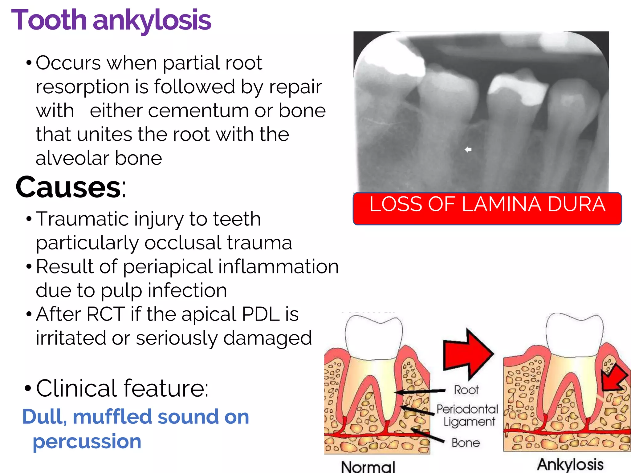 Physical injuries of oral cavity.pptx