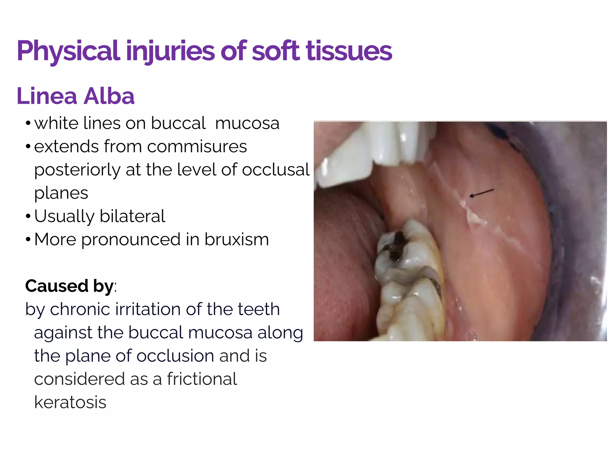 Physical injuries of oral cavity.pptx