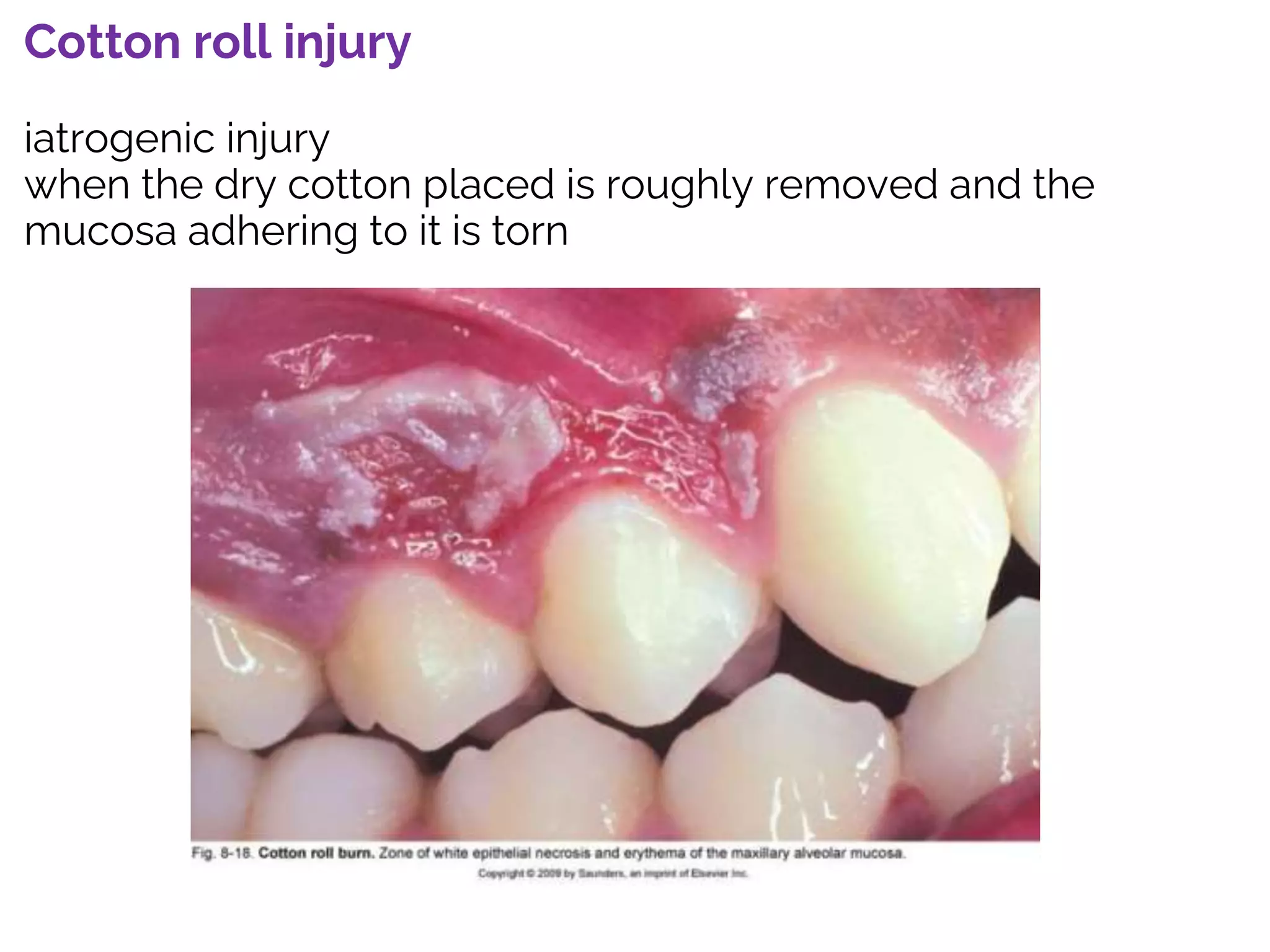 Physical injuries of oral cavity.pptx