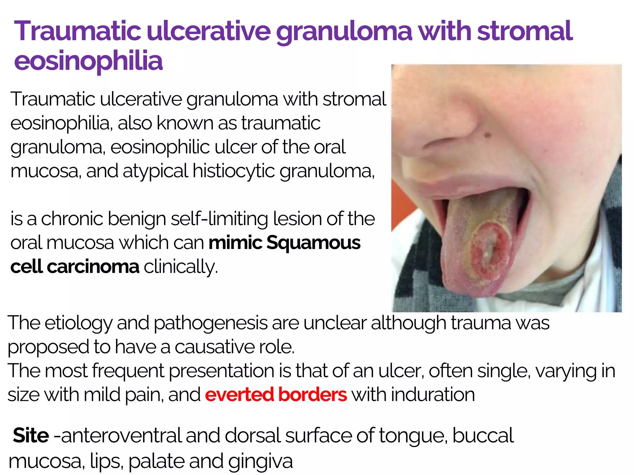 Physical injuries of oral cavity.pptx