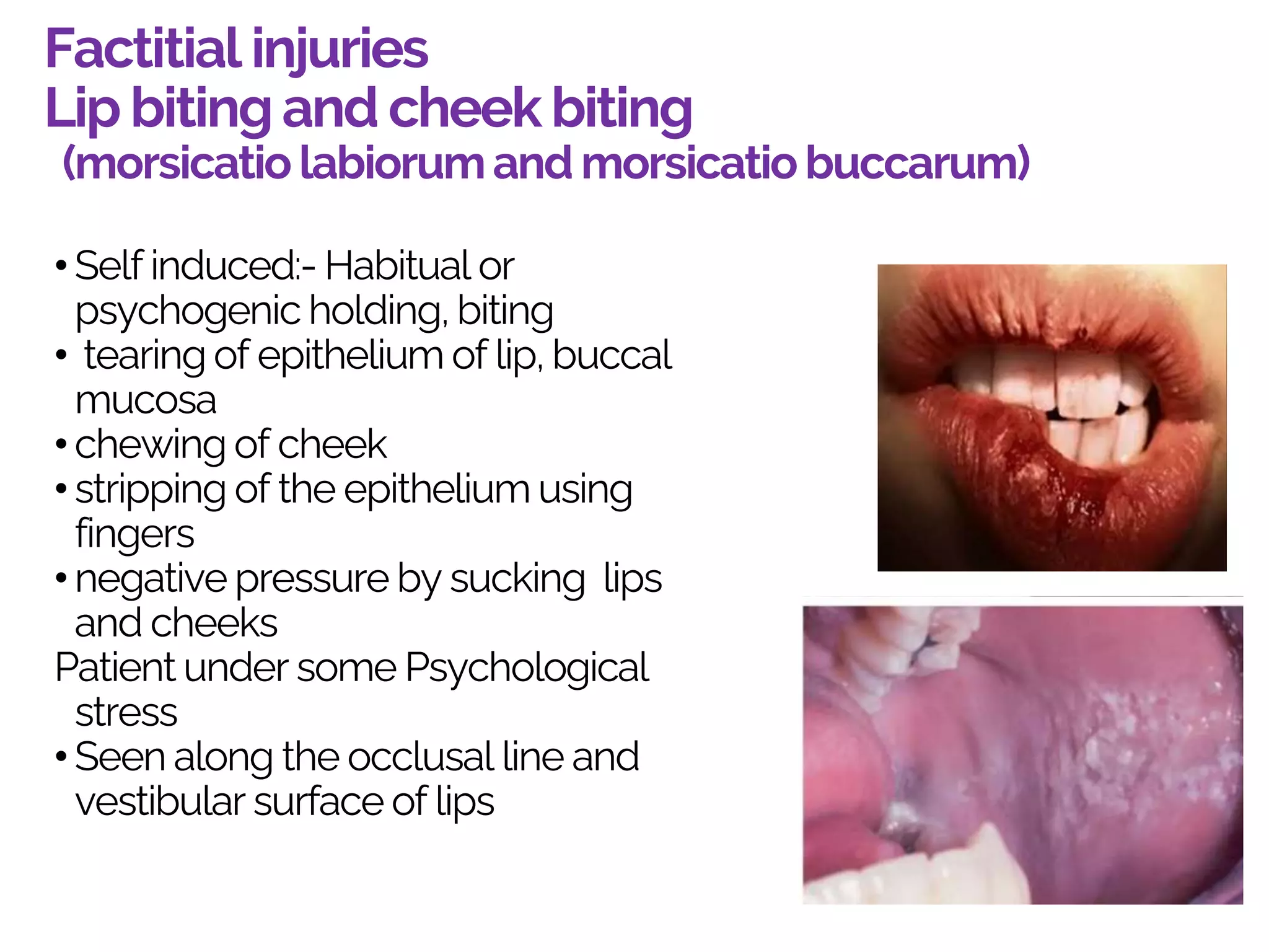 Physical injuries of oral cavity.pptx