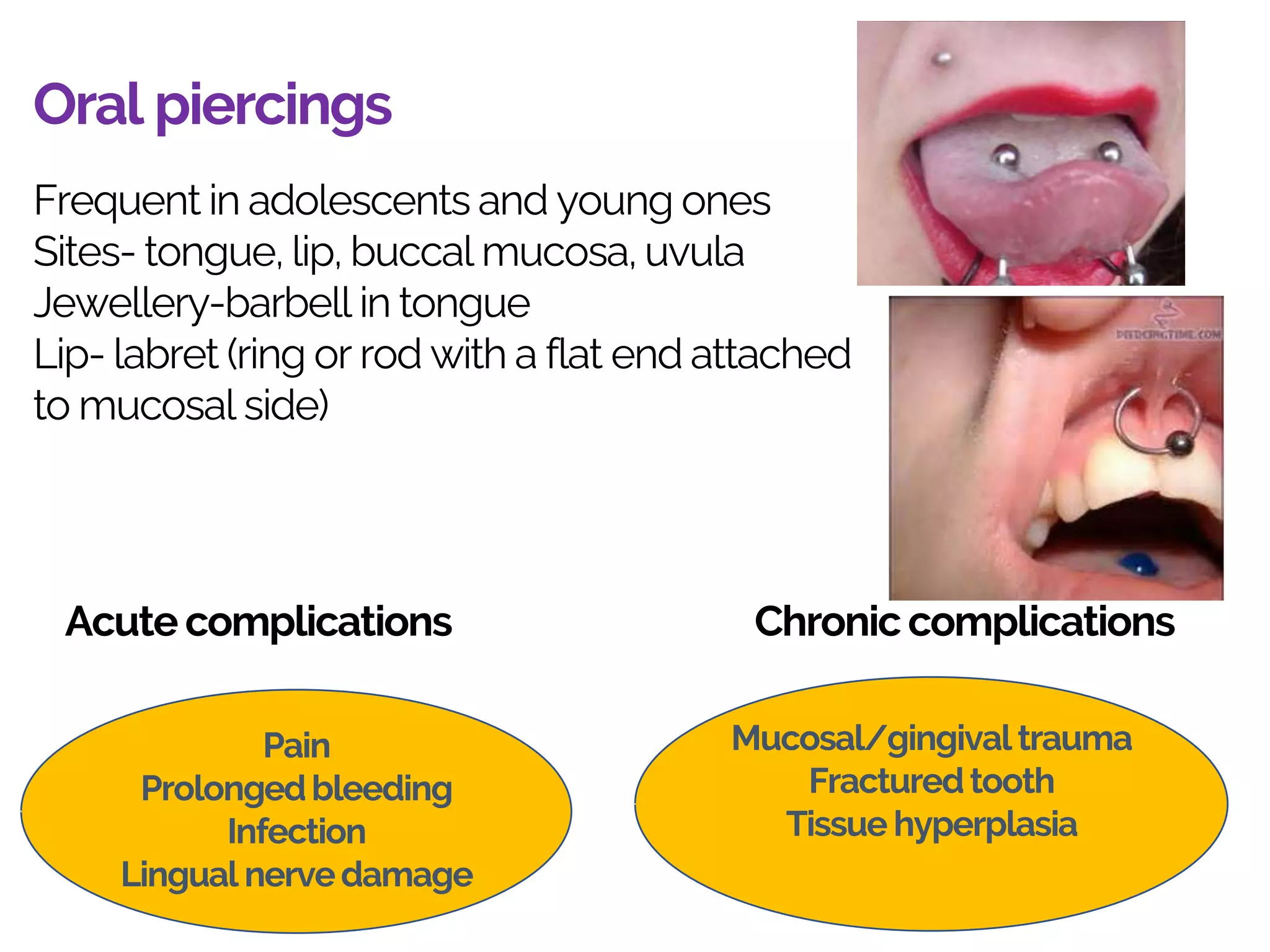 Physical injuries of oral cavity.pptx