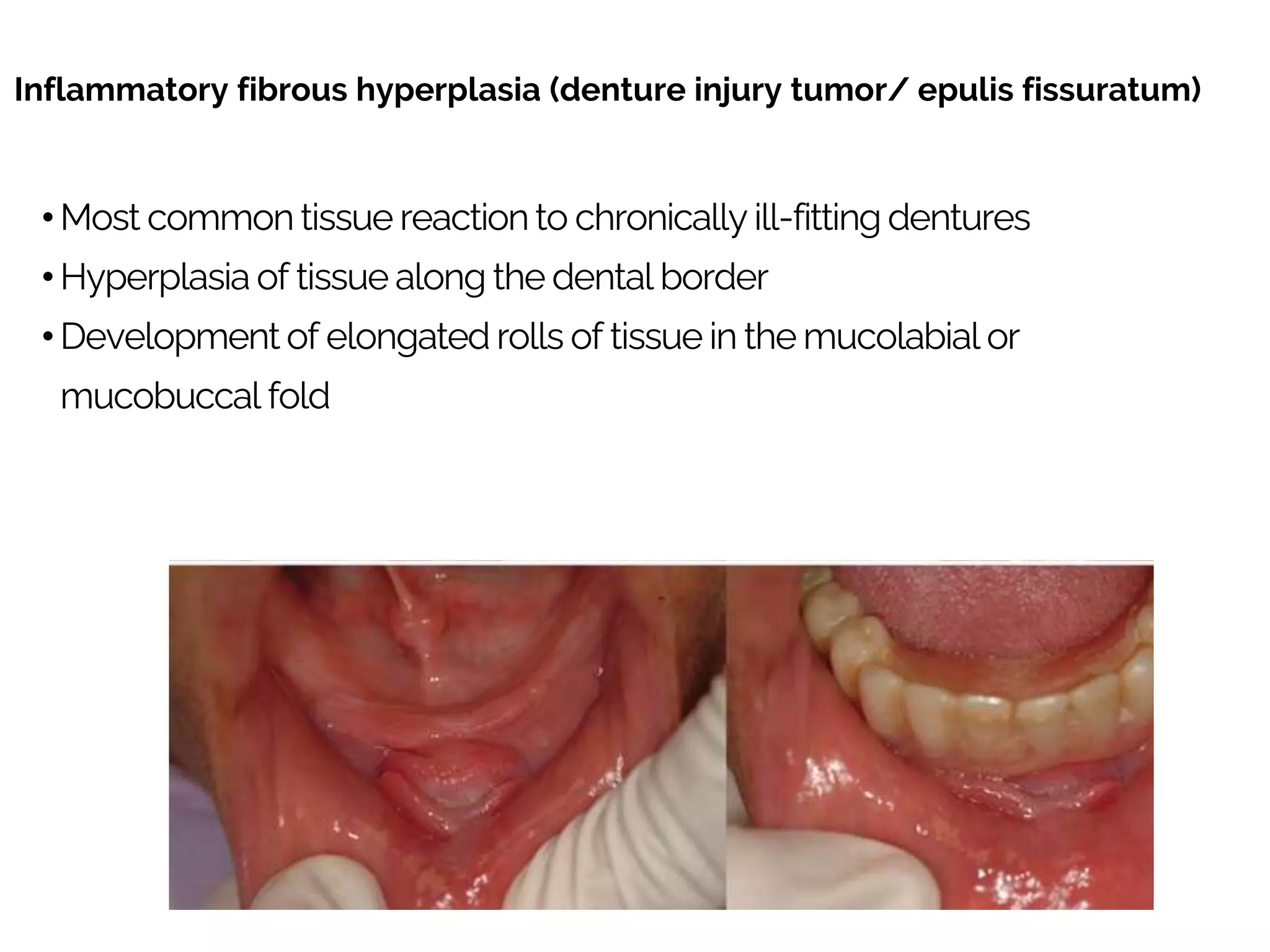 Physical injuries of oral cavity.pptx