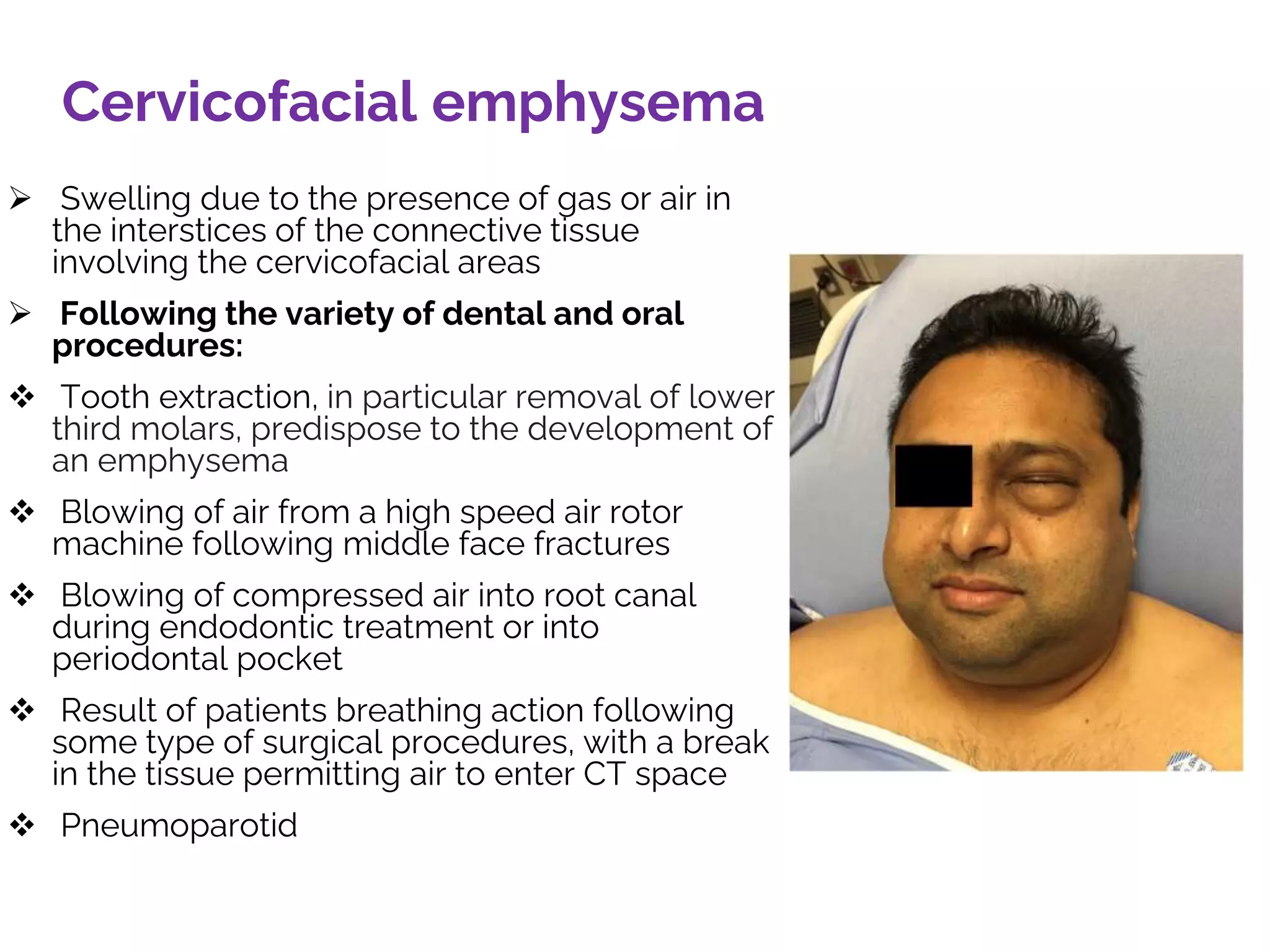 Physical injuries of oral cavity.pptx