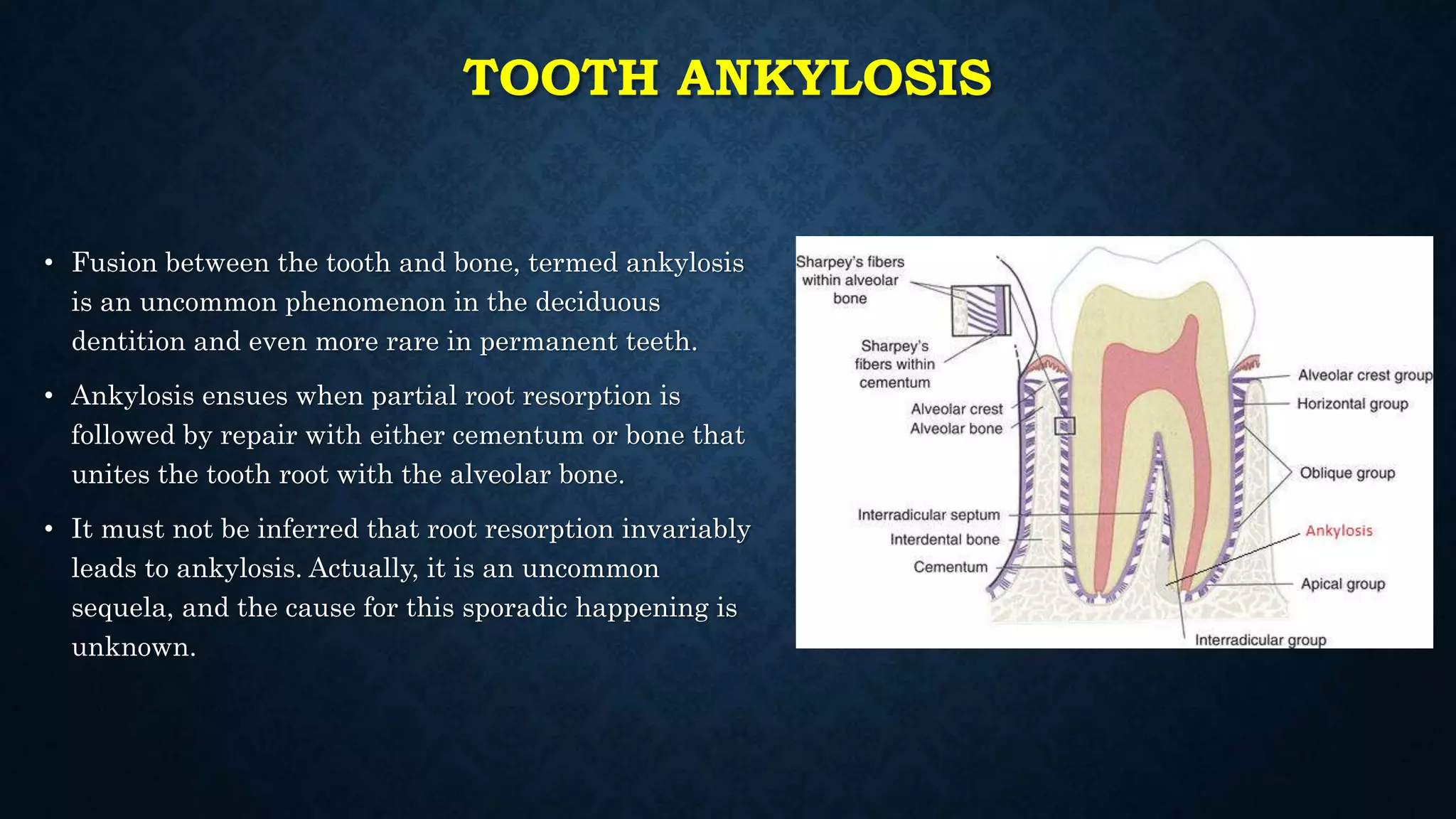 Physical injuries of teeth | PPTX