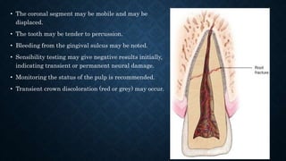 Physical injuries of teeth | PPTX