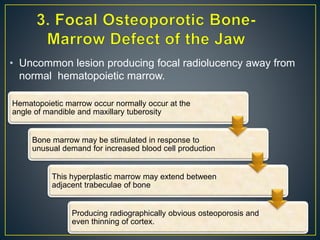 Physical injury to the bone | PPT