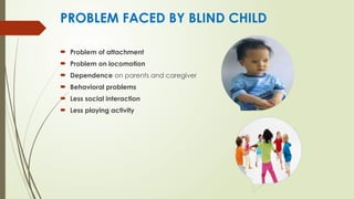physically challenged child/ physically handicap child.pptx