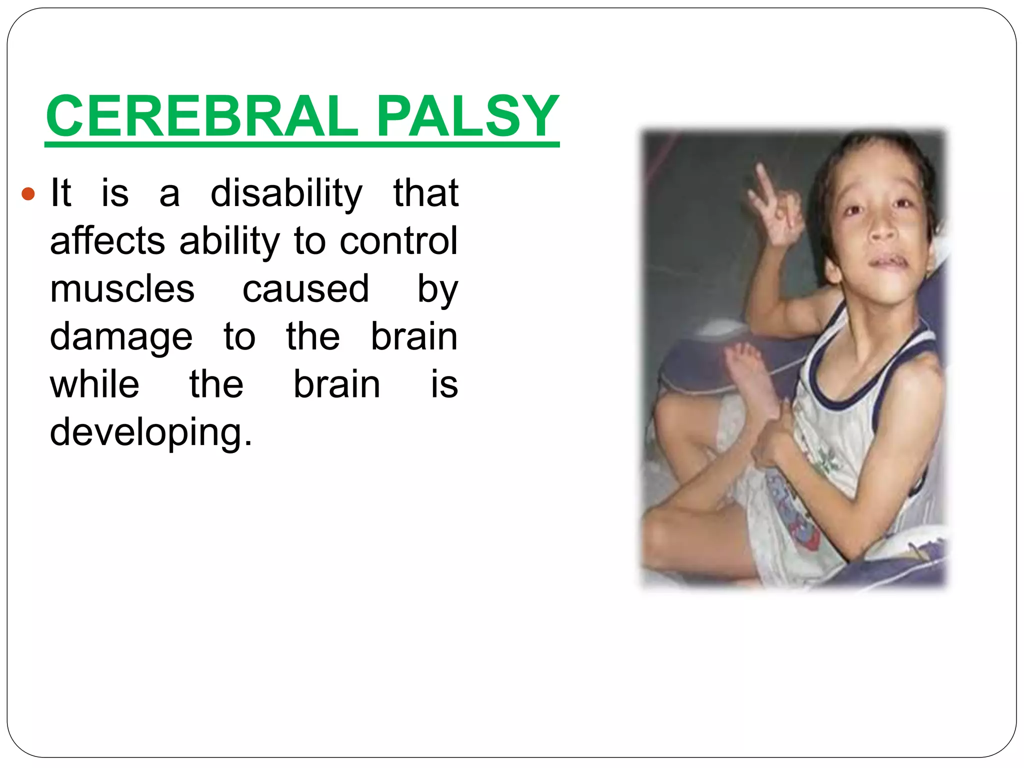 PHYSICALLY ,MENTALLY &SOCIALLY CHALLANGED CHILDREN | PPTX