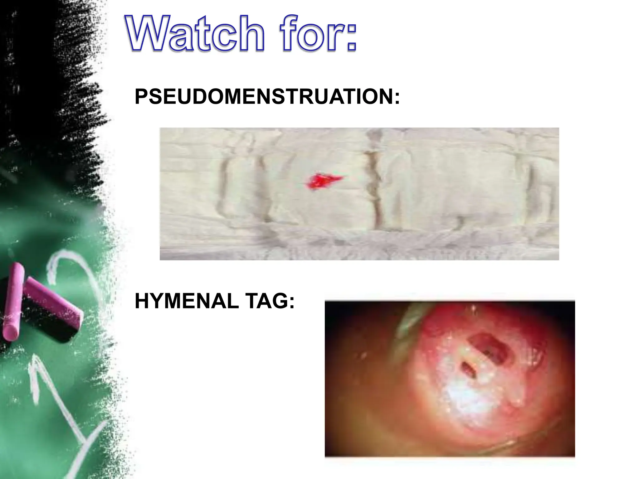 physical & behavioral assessment of nweborn.ppt