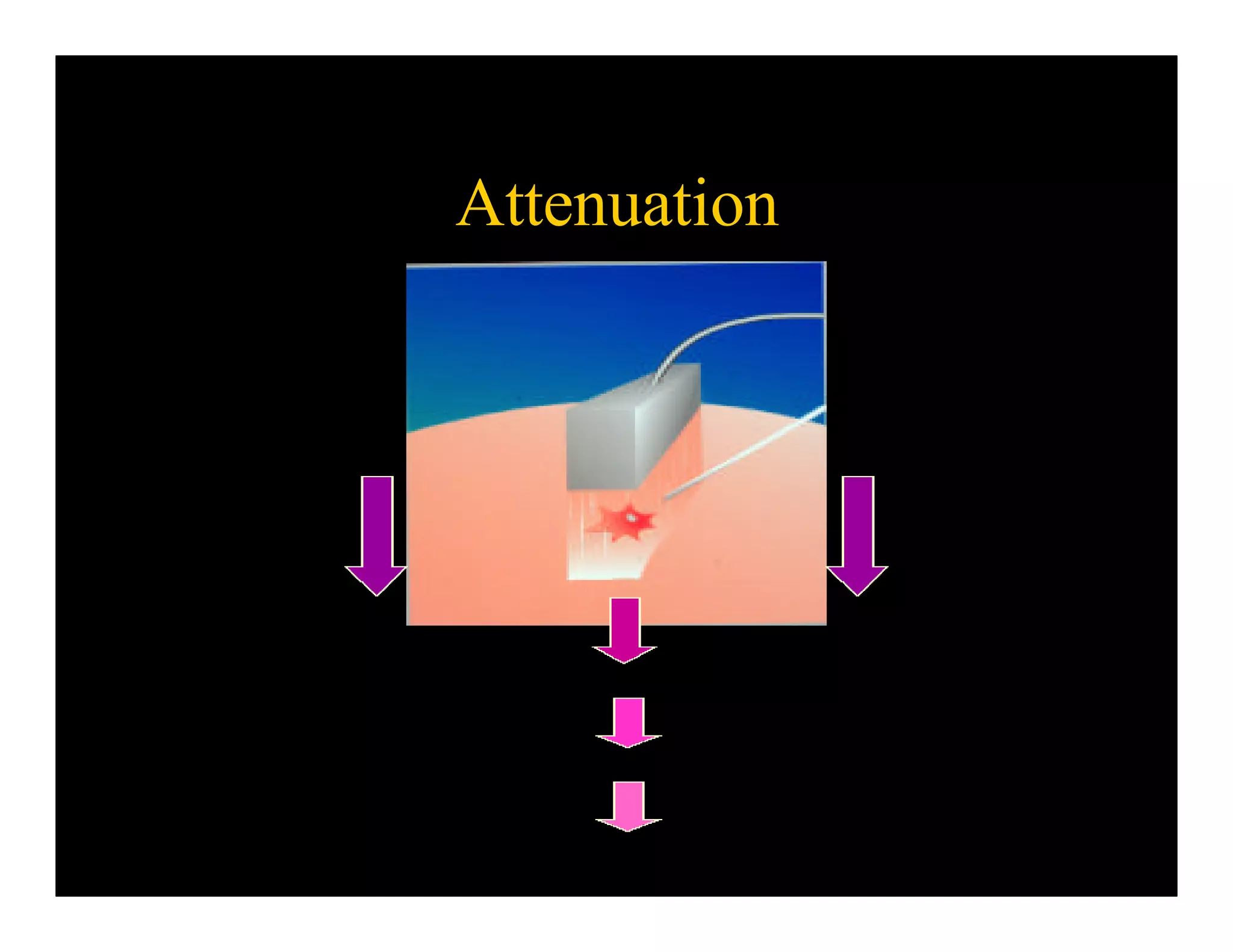 Physical Principles Of Ultrasound | PDF