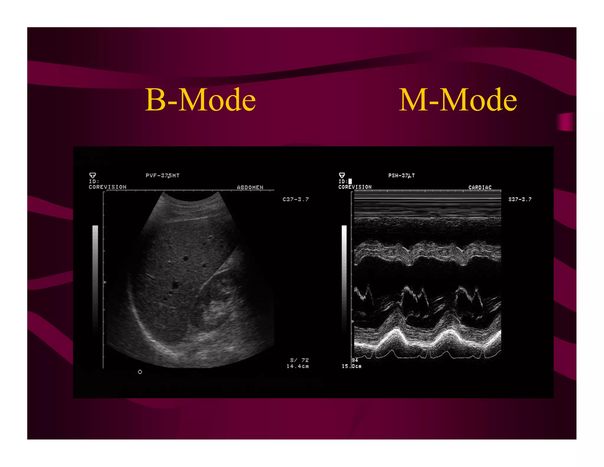Physical Principles Of Ultrasound | PDF