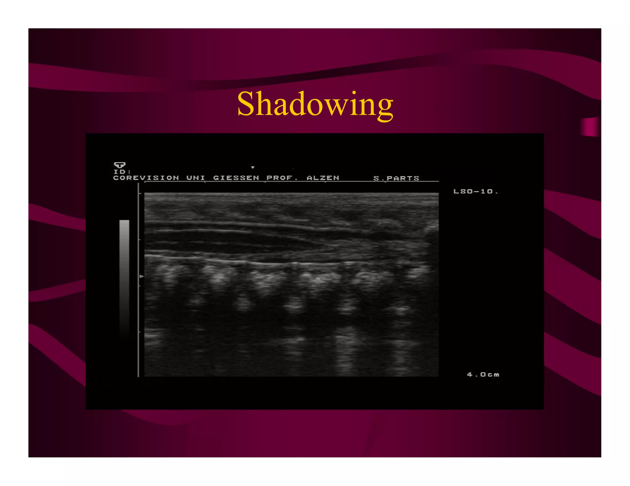 Physical Principles Of Ultrasound | PDF
