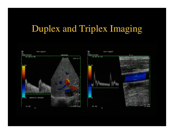 Physical Principles Of Ultrasound