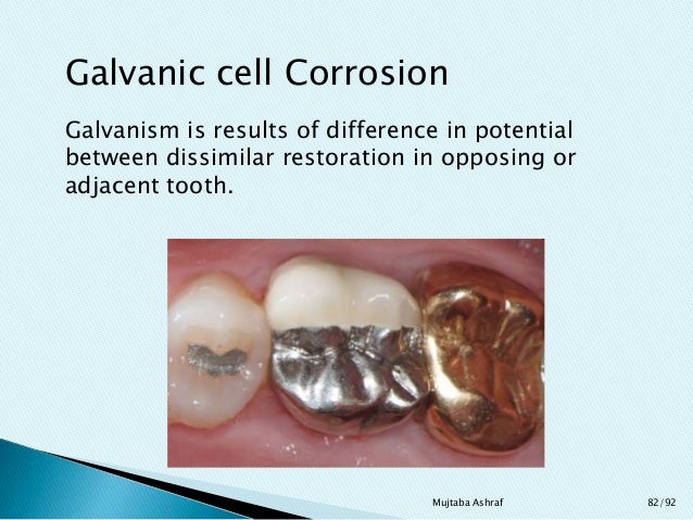 Physical properties of dental materials by Dr Mujtaba Ashraf
