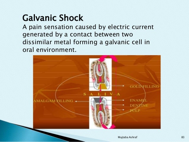 Physical properties of dental materials by Dr Mujtaba Ashraf