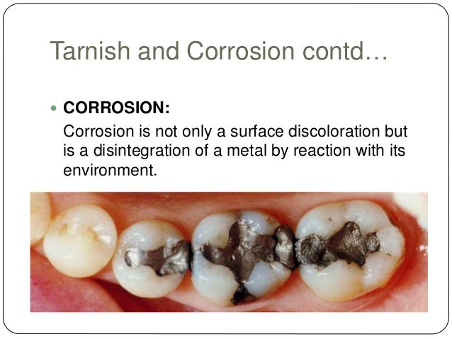 Physical Properties of Dental Materials