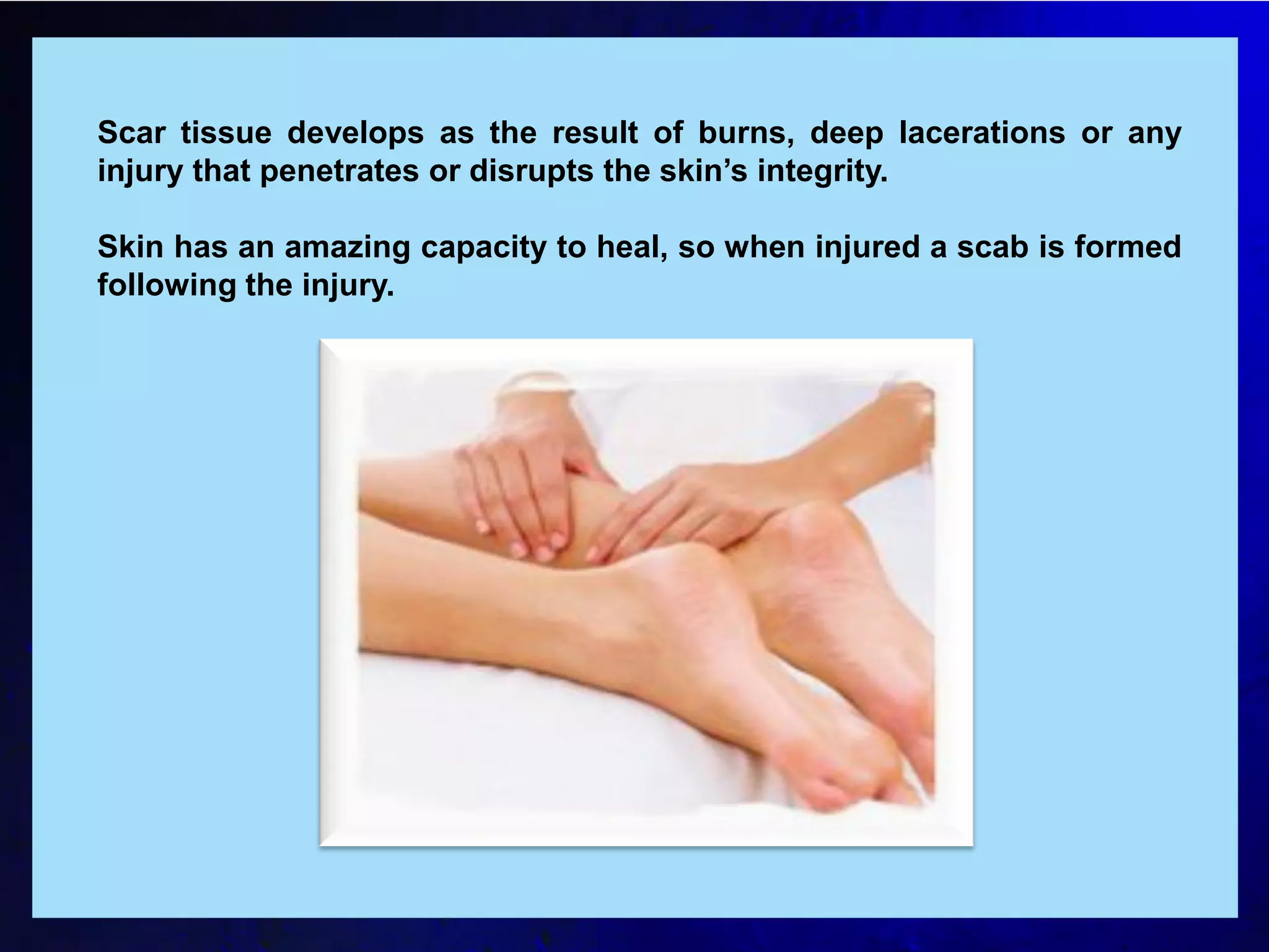 Physical Therapy For Scar Tissue | PDF