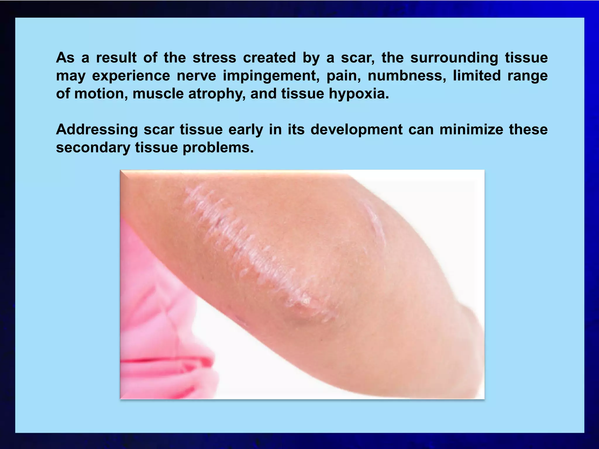 Physical Therapy For Scar Tissue | PDF