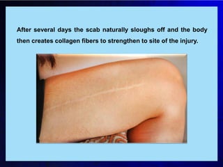 Physical Therapy For Scar Tissue | PDF