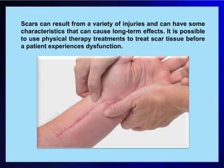 Physical Therapy For Scar Tissue | PDF