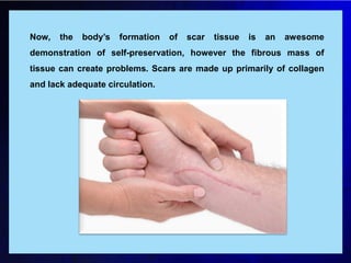 Physical Therapy For Scar Tissue | PDF