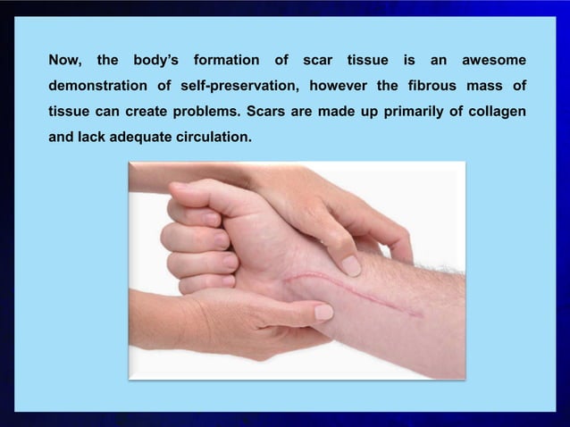 Physical Therapy For Scar Tissue | PDF | Death, Injury, or Military ...