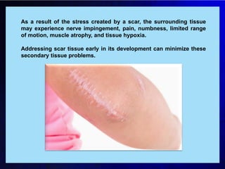 Physical Therapy For Scar Tissue | PDF