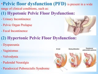 Physical therapy for specific female pelvic floor related dysfunction ...
