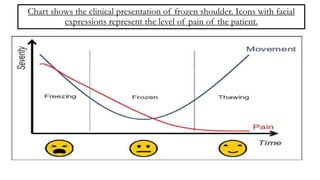 Physical therapy in the management of frozen shoulder | PPTX