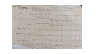 physicon ivc 1.pptx
