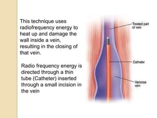 Heat In Medicine | PPT